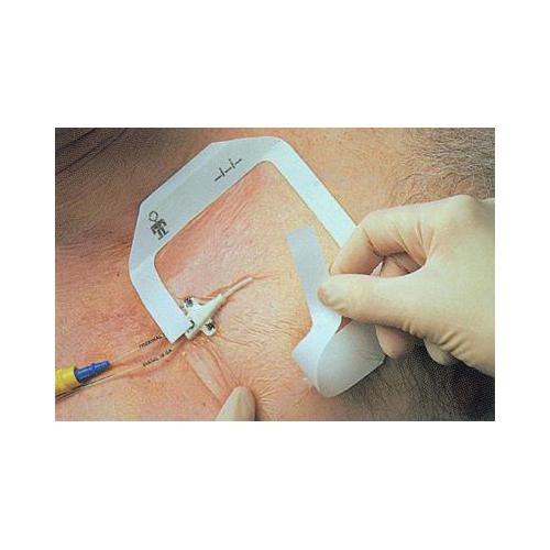 Epigard 8cmx5cm AP 10 synthetischer Hautersatz | 7600000010255